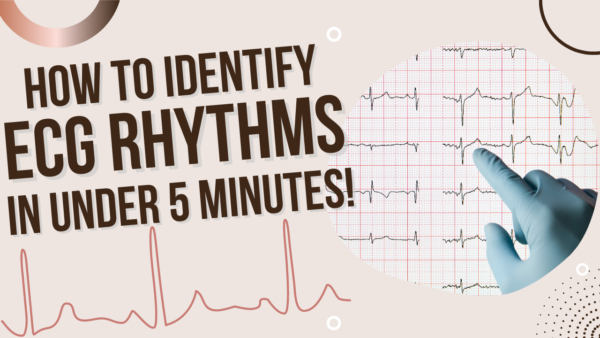 How to Identify ECG Rhythms in Under Five Minutes! – NurseCheung.com